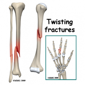 St. Albert Physical Therapy & Sports Injury Clinic Inc. :: Spiral ...